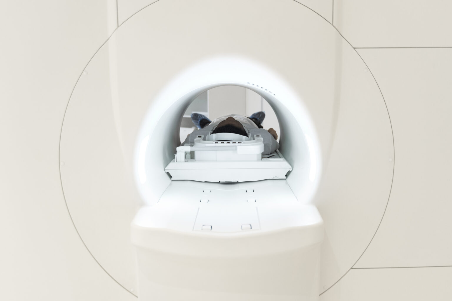 7 Benefits of MRI Scans for Accurate Diagnosis